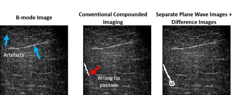 Deep Learning In Medical Ultrasound Medical Engineering