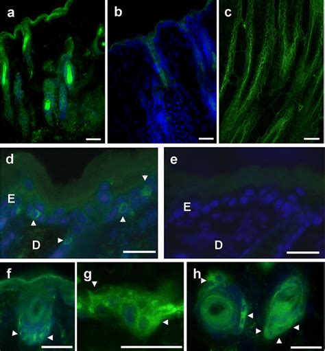 Adam9 Is Strongly Expressed In The Epidermis And In The Outer Root