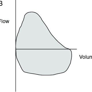 Demonstration Of Various Flow Volume Loops A Normal Flow Volume Download Scientific Diagram