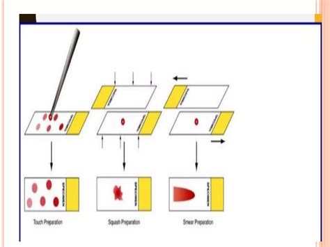 Diagnosticcytopathologypptx