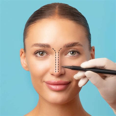 How To Make Your Nose Smaller Small Nose Job In Turkey Yaman Surgery
