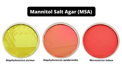 Mannitol Salt Agar Msa Composition Principle Preparation Results