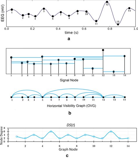 Eeg Based Classification Of Epilepsy And Pnes Eeg Microstate And Functional Brain Network
