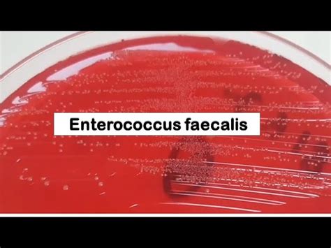 Enterococcus Faecalis On Blood Agar Colony