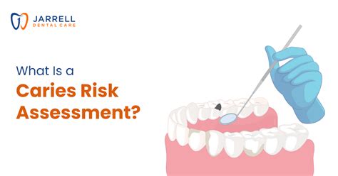 Caries Risk Assessment A Tool For Prevention