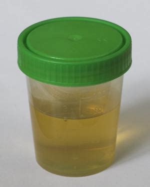 Difficulty Urinating In The Morning General Center SteadyHealth Com