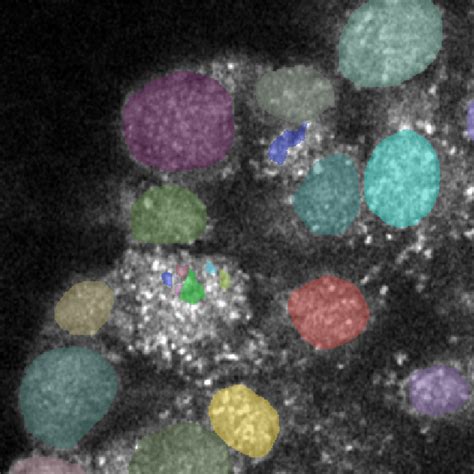 Cellpose Results Different Between D And D Using Stitch Usage Issues Image Sc Forum
