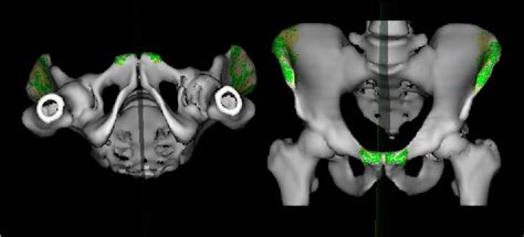 In The Figure Only Points Belonging To Point Pairs With Symmetrical Download Scientific Diagram