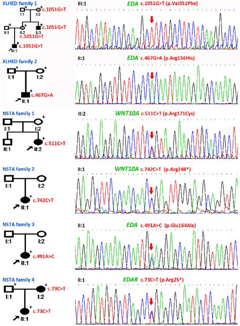 Pedigrees And Mutation Information Of X Linked Hypohidrotic Ectodermal Download Scientific