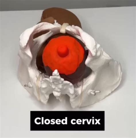 Your Cervix In Labor Birthinglover2024 On Tumblr