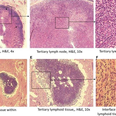 Tertiary Lymph Node Formation At The Injection Site Following Download Scientific Diagram