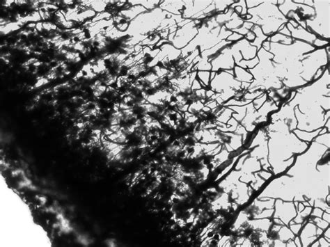 44 Questions With Answers In Golgi Staining Science Topic