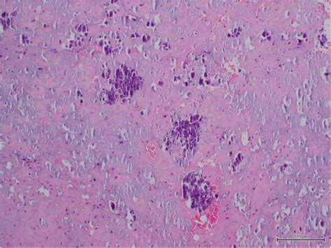 Histological Section Shows Amorphous Matrix That Contains Dense Fibrous Download Scientific