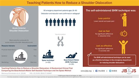 Teaching Patients How To Reduce A Shoulder Dislocation OrthoBuzz