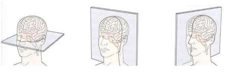 Planes Of Sectioning Diagram Quizlet