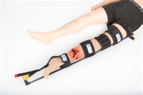 Types Of Splint Simplexplainer