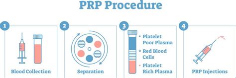 Microneedling With PRP Oakland Medical Spa Refine Anti Aging
