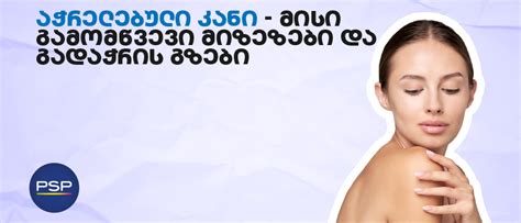 Psp Ge ონლაინ აფთიაქი