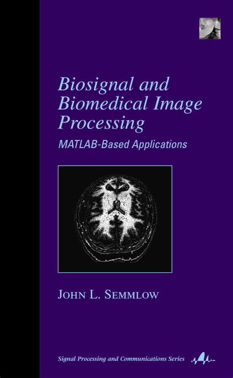 Pdf Biosignal And Biomedical Image Processing Matlab Based