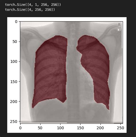 Pytorch U Net를 활용한 X Ray Segmentation 튜토리얼