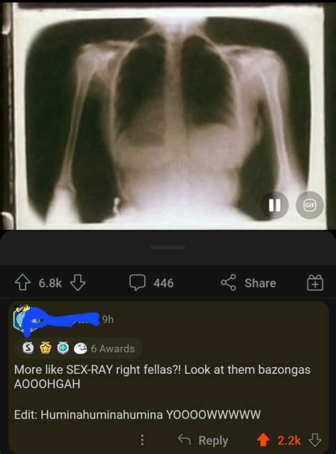 Sex Ray Im An Average Sex Haver Rshidandcamed