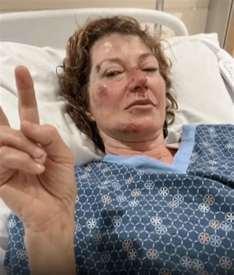 Amy Grant Says Trauma Of Bike Wreck Led To Another Diagnosis