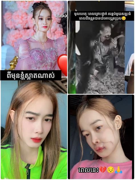 សង្គមថ្ងៃនេះ ឃើញបងប្អូនសួ រ ពី ប ញ្ហា មុ ខ គាត់ច្រើន តាមពិតគាត់ជួបគ្រោ