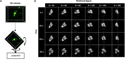 Transformer Based Spatialtemporal Detection Of Apoptotic Cell Death In