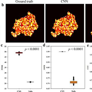 Quantitative Comparisons For K Trans Estimated By The GL CNN And Tofts Download Scientific