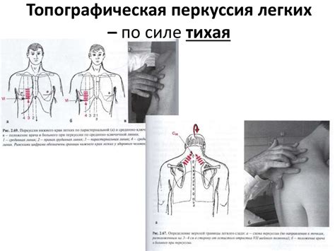 Перкуссия как метод исследования больного. Перкуссия легких в норме и ...