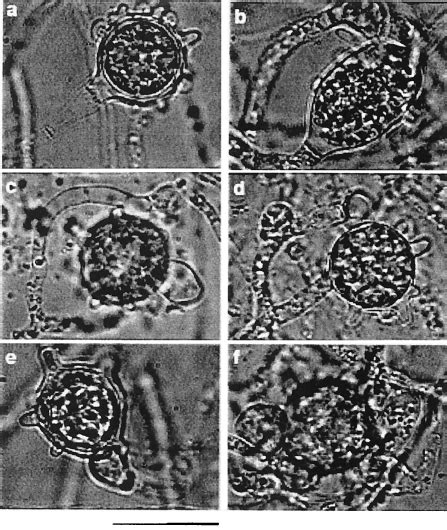 Reproductive Structures Of Pythium Regulare A Terminal Ornamented Download Scientific