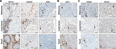 Detection Of Dendritic Cell Subsets In The Tumor Microenvironment By Multiplex