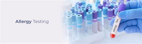 Allergy Testing Guide Types Procedures And Results