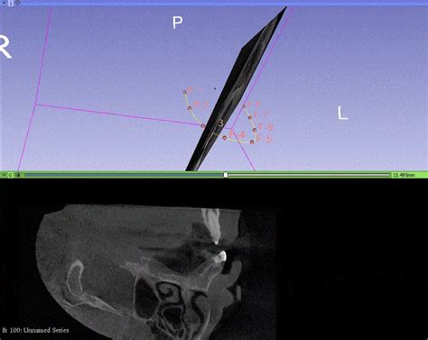 3d Slicer Viewport Rotation On Model Path In Python Stack Overflow