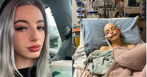 “술 두 잔에 구토 숙취인 줄 ‘이 암 진단 20대女 무슨 사연