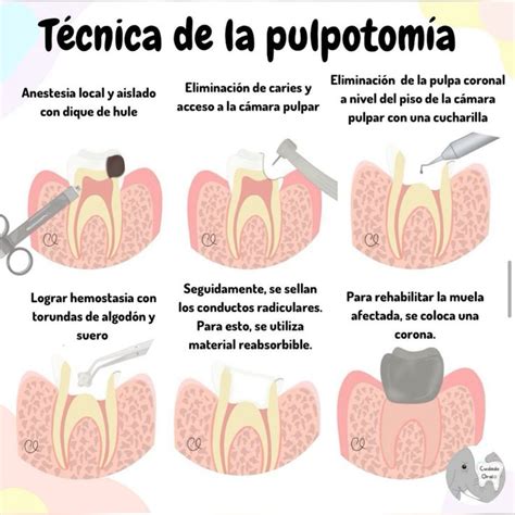 Pulpotomia