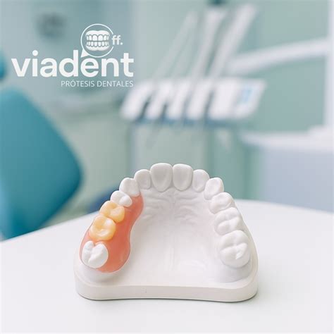 Viadent Protesis Dentales Viadentprotesisdentales • Instagram