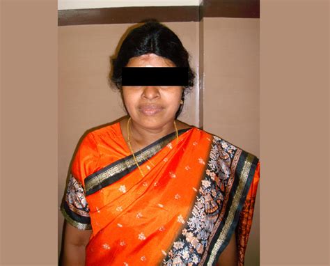 Scalp Reconstruction Thrissurplasticsurgery