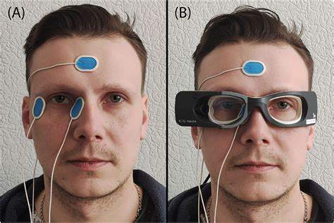Frontiers Comparison Of Eog And Vog Obtained Eye Movements During Horizontal Head Impulse Testing