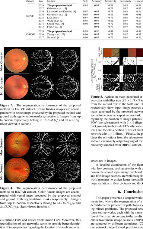 vessel segmentation performance comparison on drive and iostar