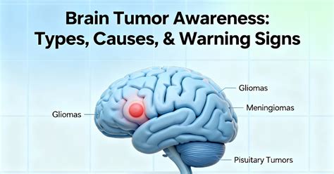 Understanding Brain Tumors Types Causes And Warning Signs