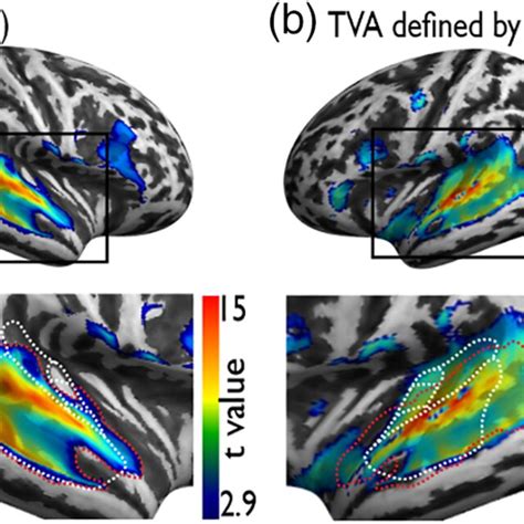 Neural Activation For Task‐based And Passive Vocal‐sound Processing