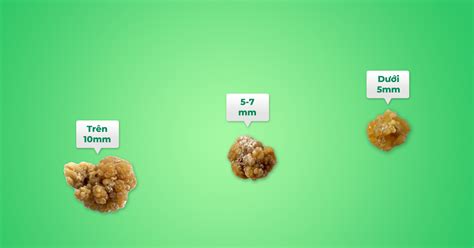 Soi 3mm Co Phai Mo Khong 2 Sỏi Mật Trái Sung