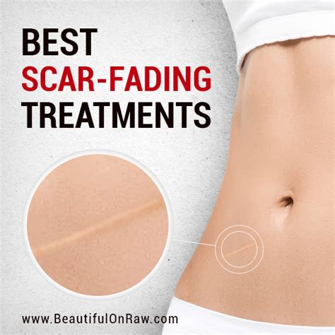 How To Remove Scars On Face And Body Naturally Beautiful On Raw