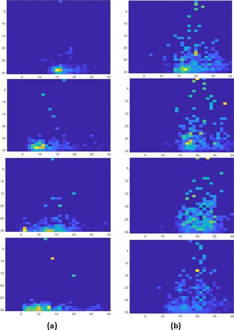 A Persistence Image Representation Of Hepatic Decompensation Within A