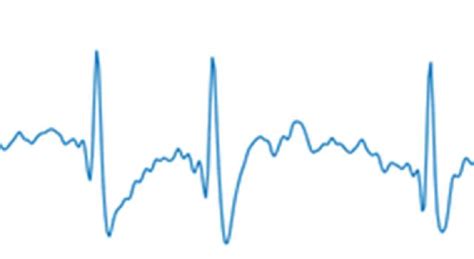 Ai In Epilepsy And Sleep Venture Kick