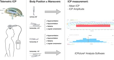 Outpatient Maneuver Protocol For Telemetric Intracranial Pressure Download Scientific Diagram