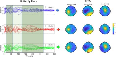 Figure 1 From The Effect Of Stimulation Frequency On Transcranial