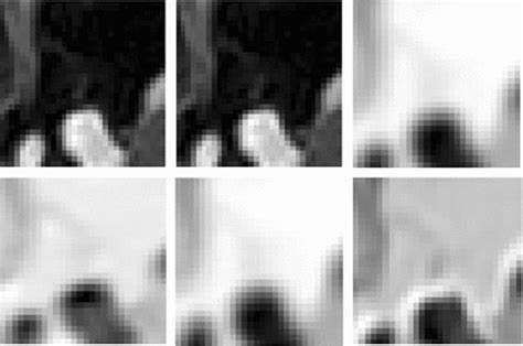Some Feature Maps Obtained By The First Convolution Layer Where The