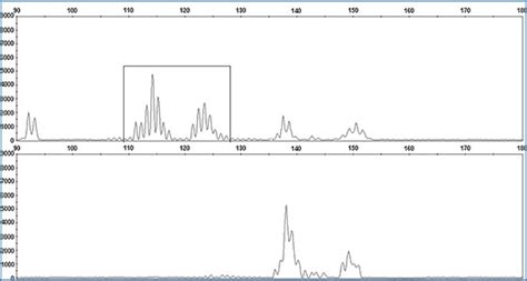 Optimization Of Small Rna Library Preparation Protocol From Human Urinary Exosomes Exosome Rna